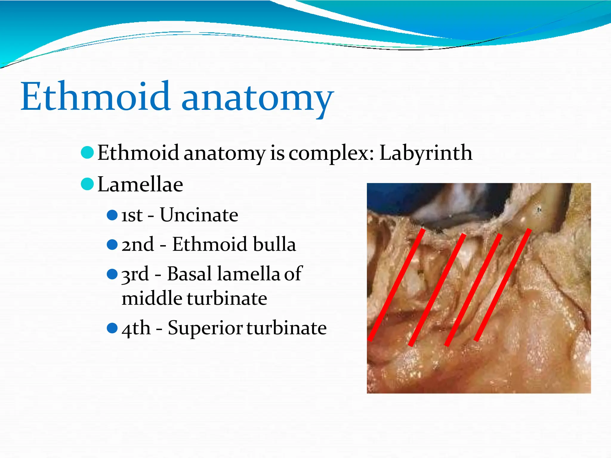 primary-sinus-surgery_compress.pptx