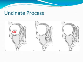 primary-sinus-surgery_compress.pptx