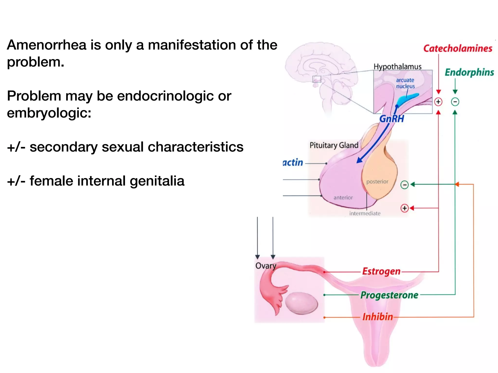 Primary amenorrhea | PDF