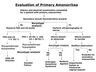 Primary Amenorrhea Algorithm