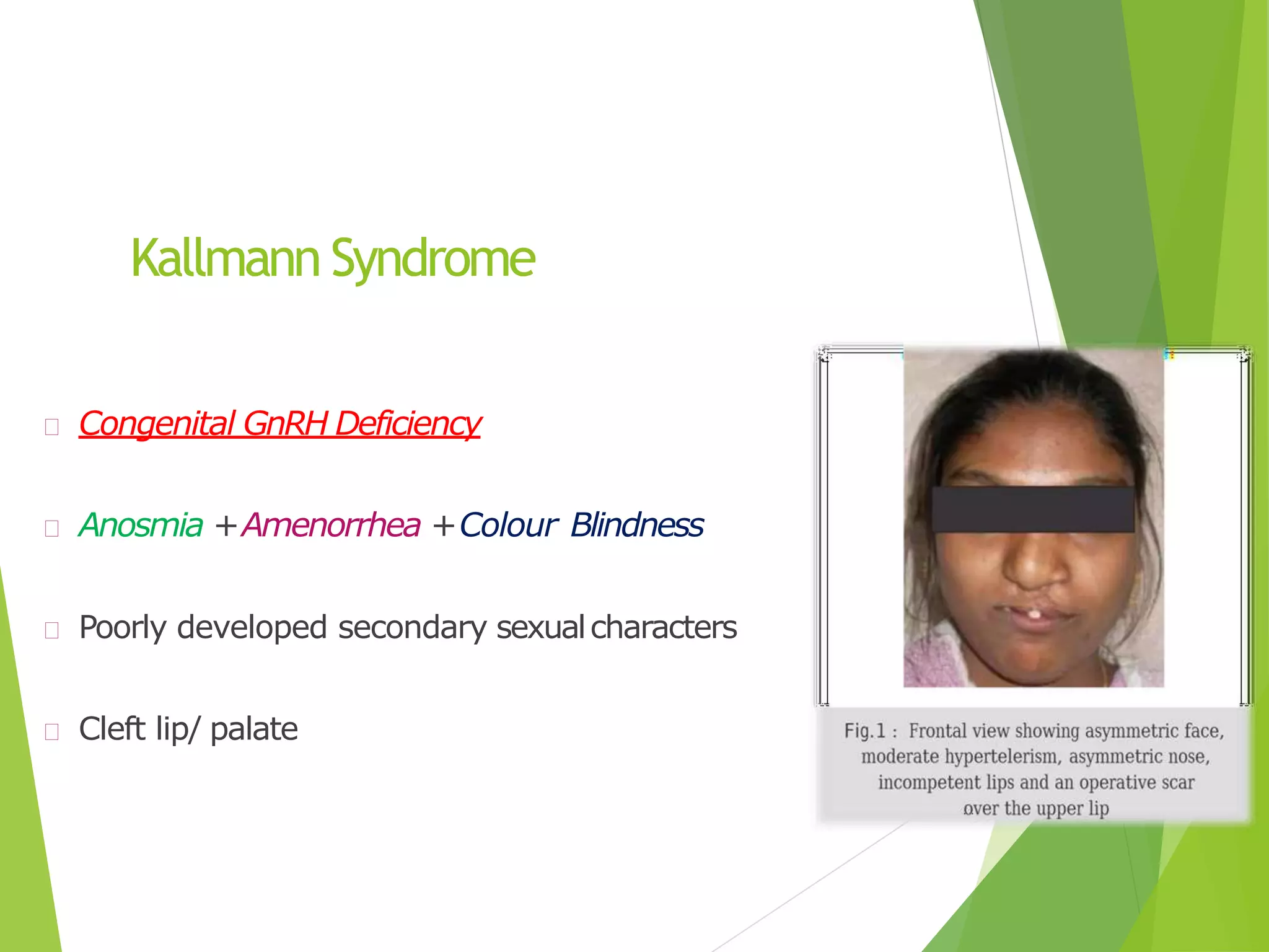 Primary amenorrhea and management | PPTX