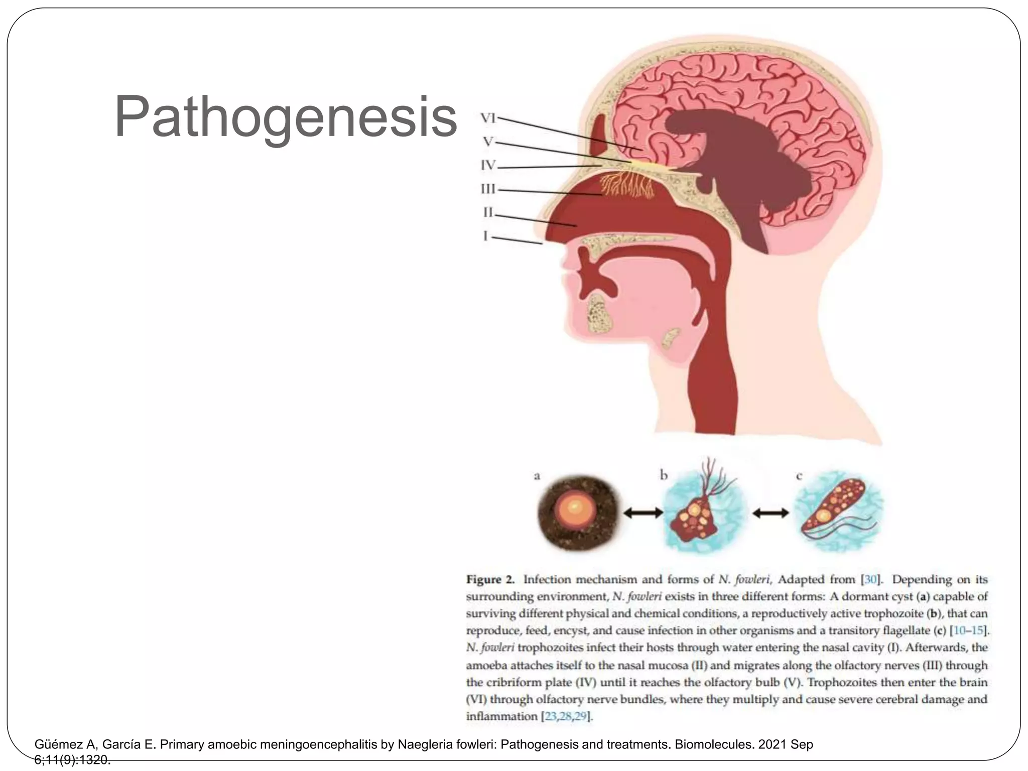 Primary Amoebic Meningoencephalitis.pptx