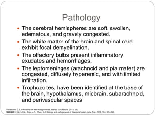 Primary Amoebic Meningoencephalitis.pptx