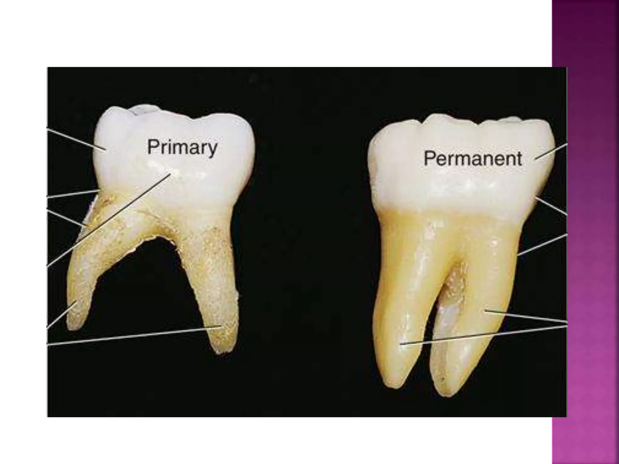 Difference between Primary and permanent teeth | PPTX