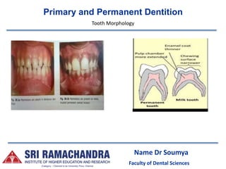 Tooth Morphology -Primary and Permanent Teeth.pptx