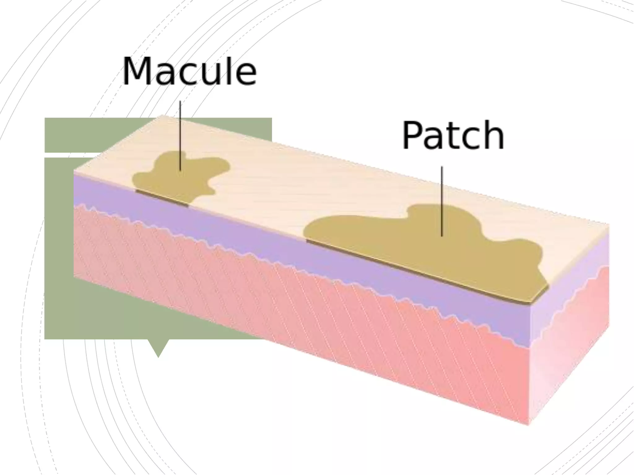 Primary and secondary lesions ( oral medicine) | PPTX