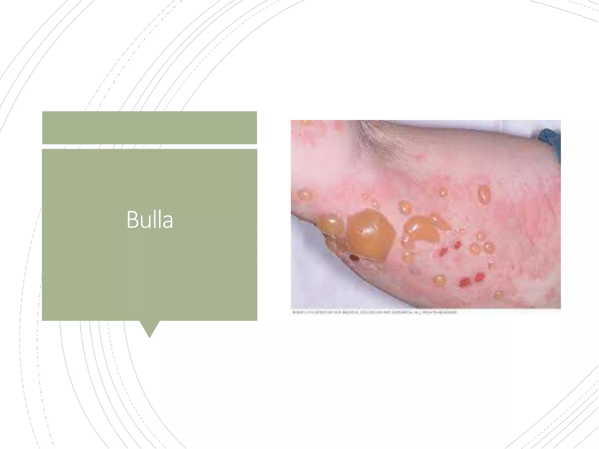 Primary and secondary lesions ( oral medicine) | PPTX