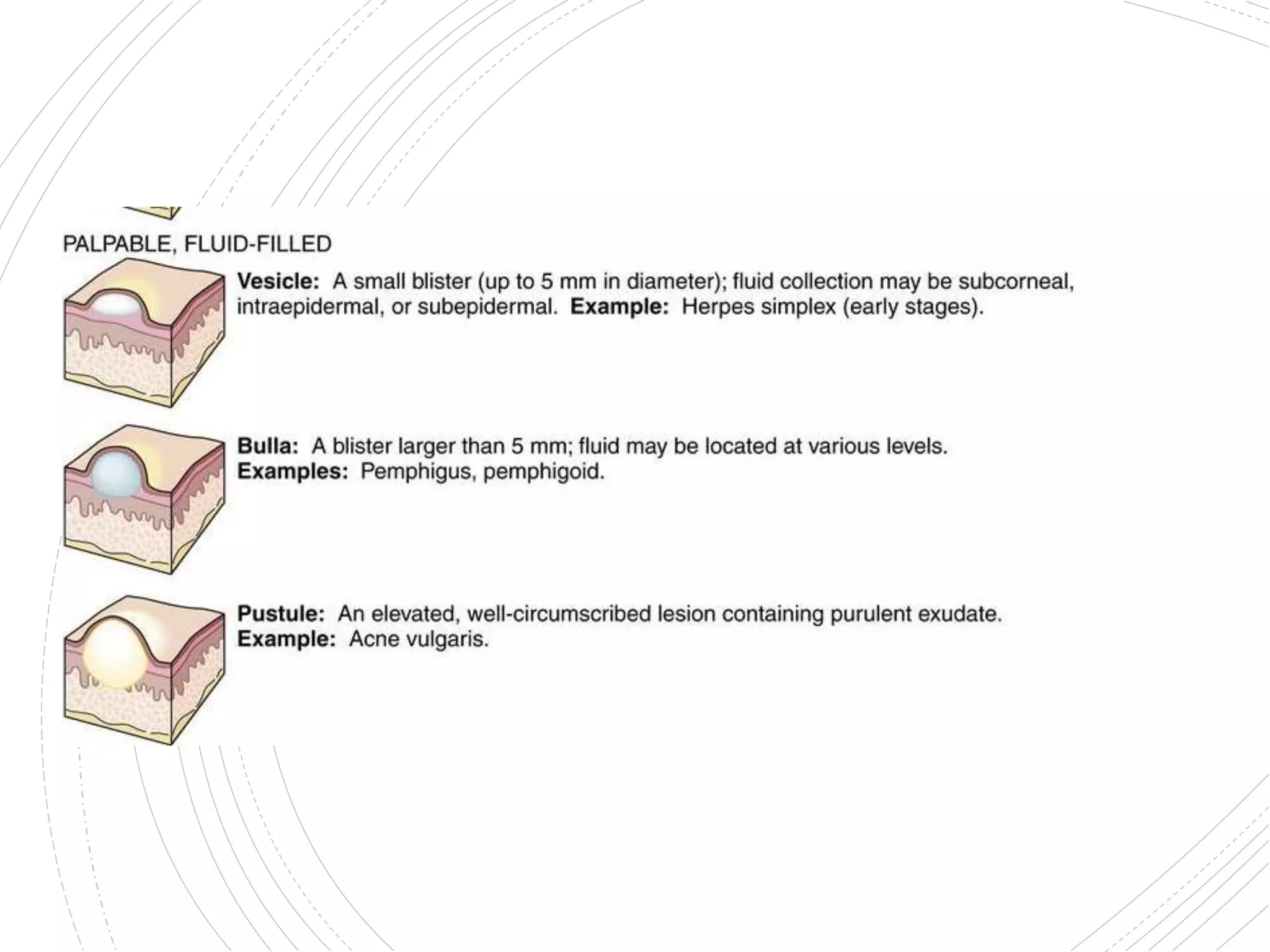 Primary and secondary lesions ( oral medicine) | PPTX