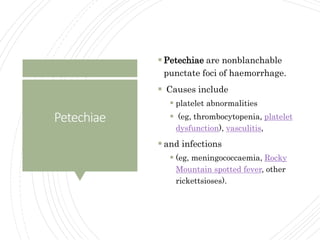 Primary and secondary lesions ( oral medicine) | PPTX
