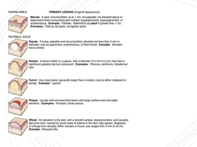 Primary and secondary lesions ( oral medicine) | PPTX | Skin and ...