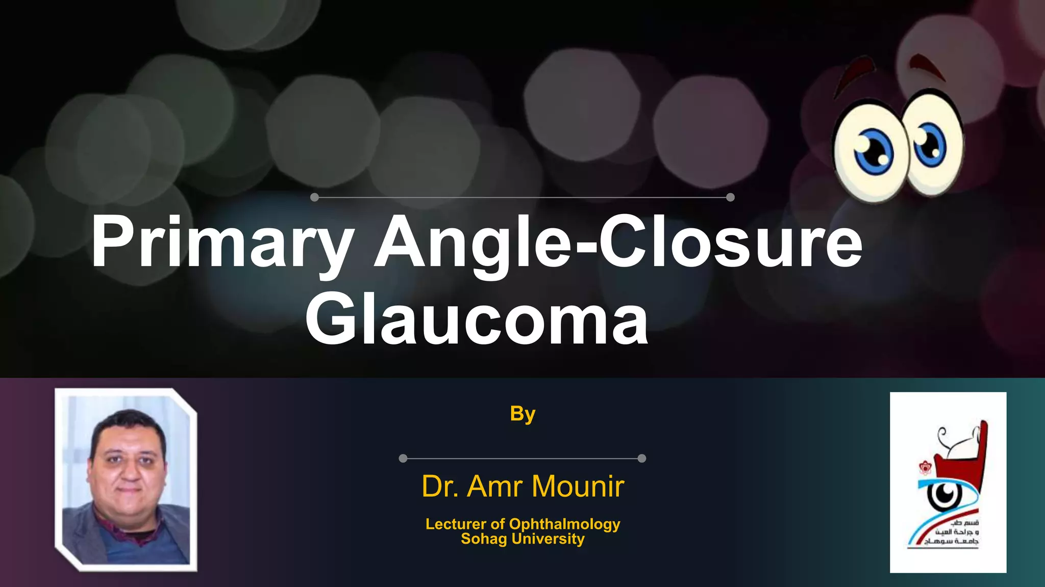 Primary angle closure glaucoma | PPTX
