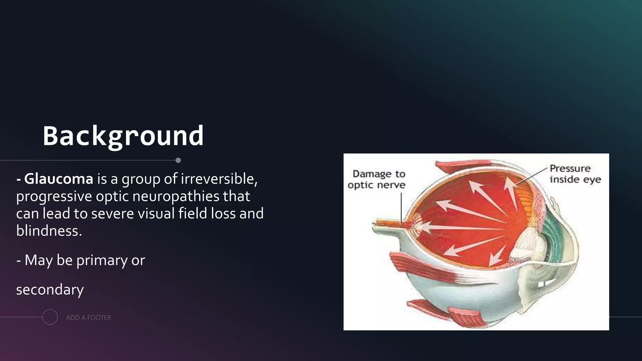Primary angle closure glaucoma | PPTX