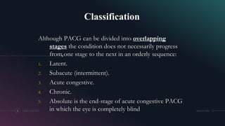 Primary angle closure glaucoma | PPTX