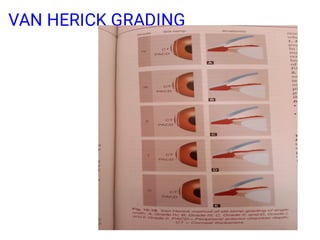 PRIMARY ANGLE C-WPS Office.pdf