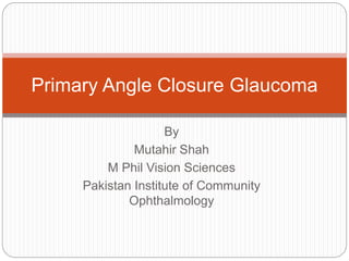 Primary angle closure glaucoma | PPTX