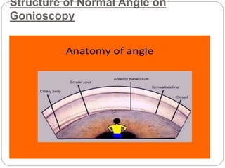 Primary angle closure glaucoma | PPTX