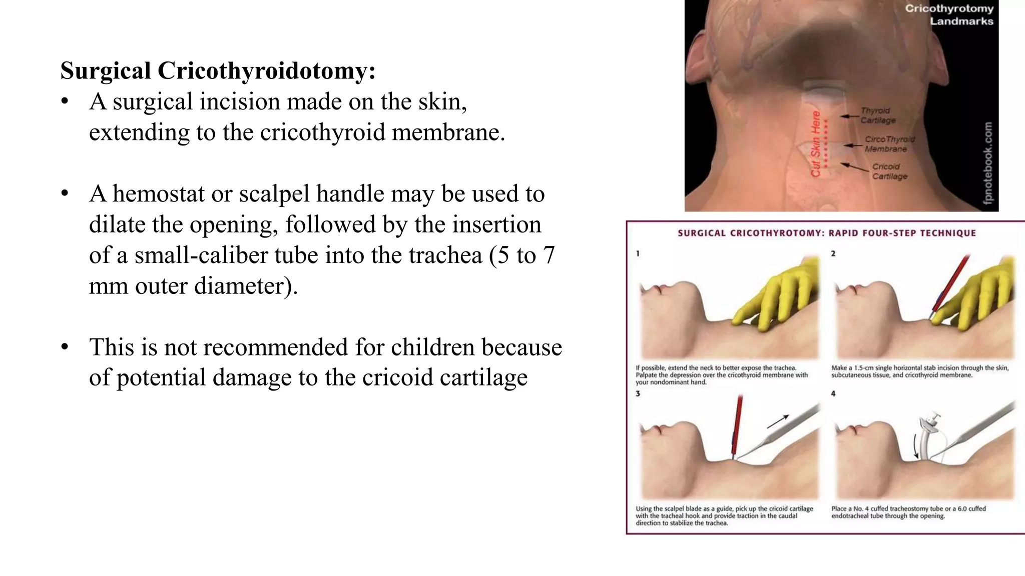 Primary assessment in maxillofacial trauma.pptx
