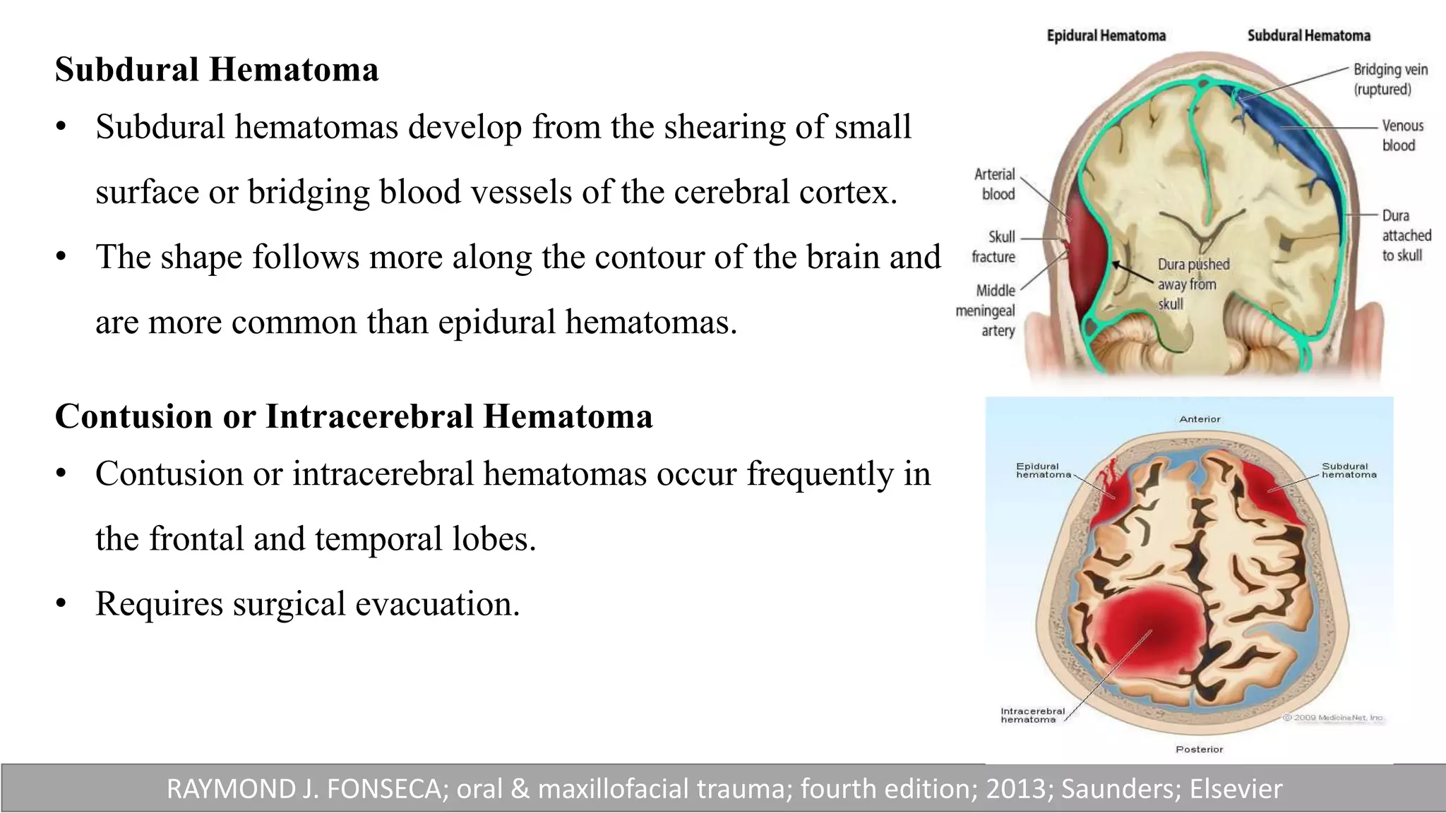 Primary assessment in maxillofacial trauma.pptx