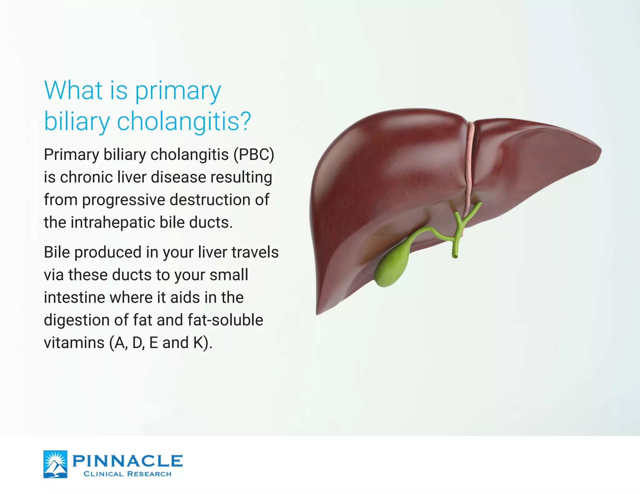 Primary Biliary Cholangitis | PPT