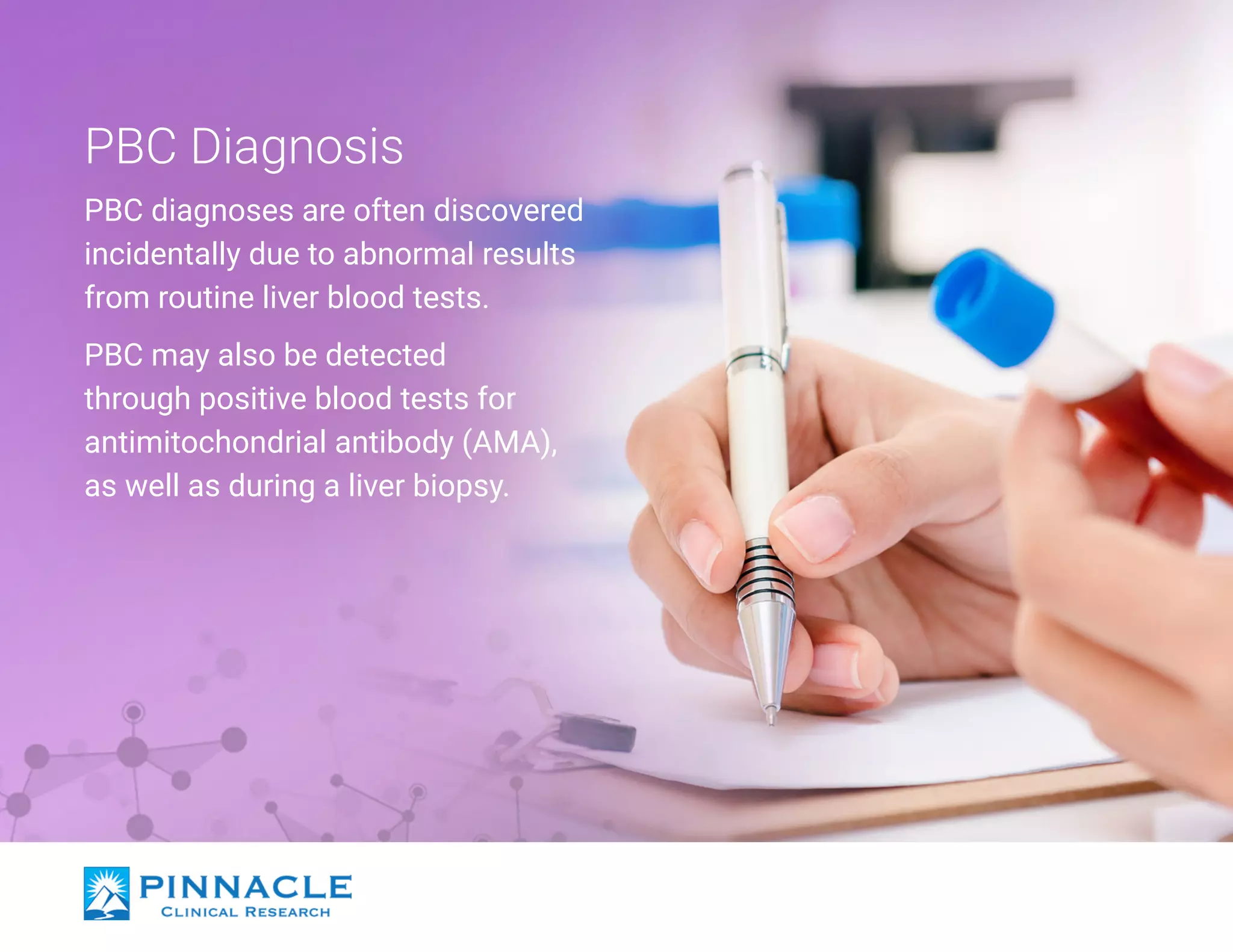 Primary Biliary Cholangitis | PDF