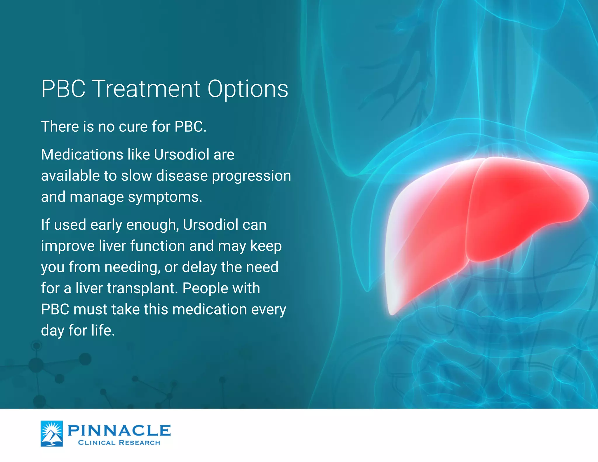 Primary Biliary Cholangitis | PDF