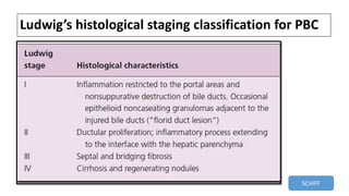 Primary Biliary cholangitis, lecture class for MBBS | PPTX