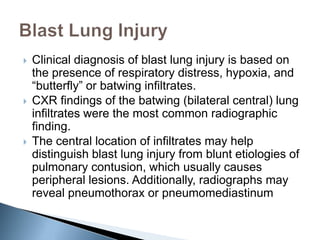 Primary Blast Injury | PPTX