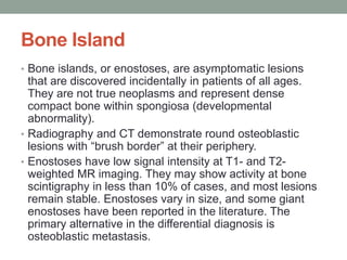 Primary bone tumors of the spine | PPTX