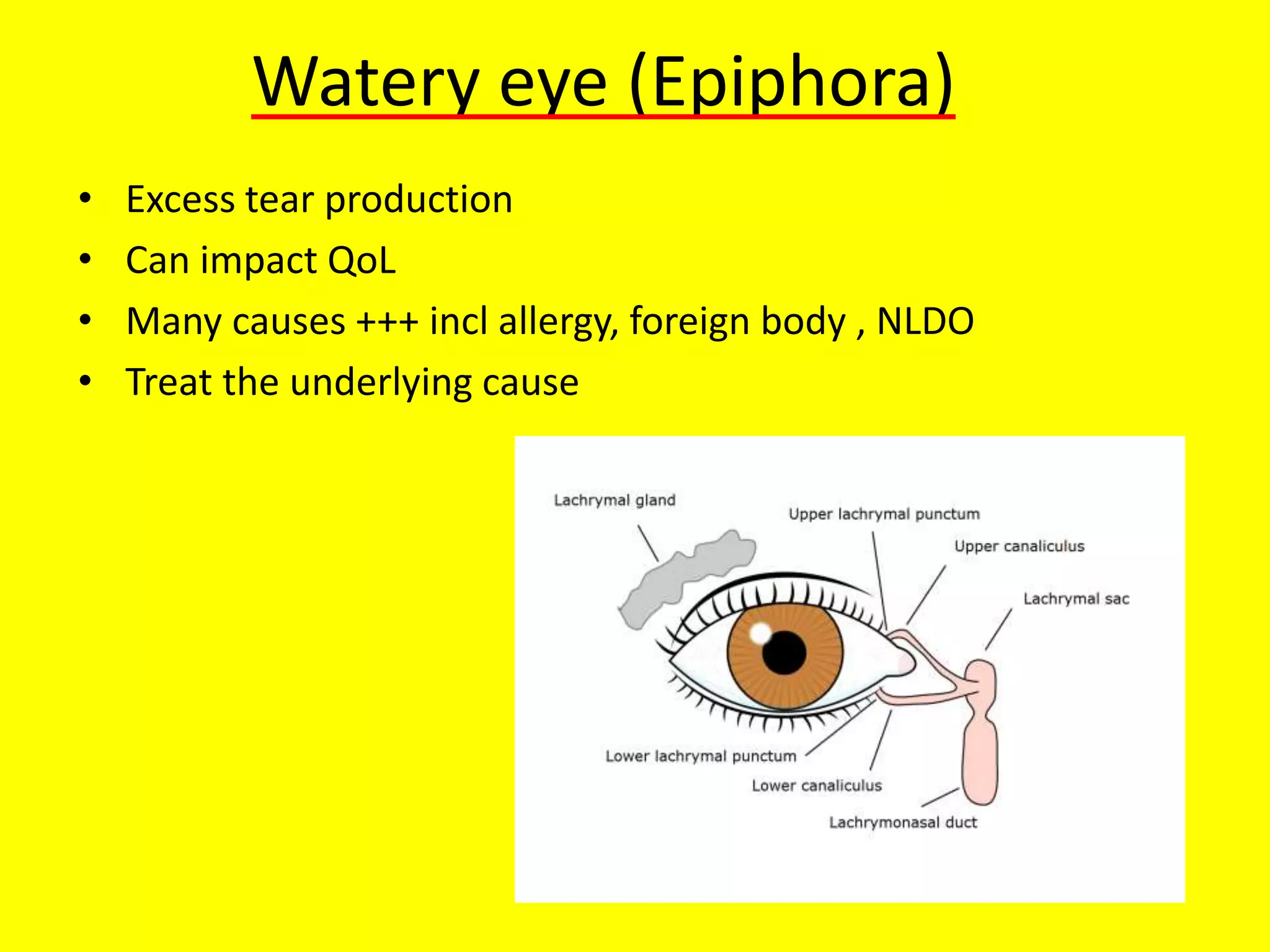 Primary care ophthalmology teaching | PPTX