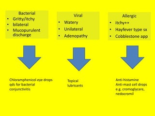 Primary care ophthalmology teaching | PPTX