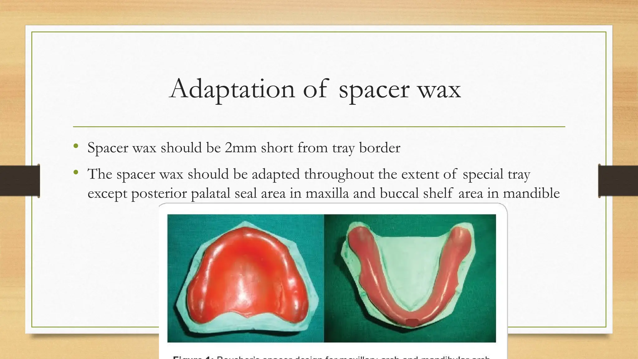 primary cast & special tray in complete dentures.pptx