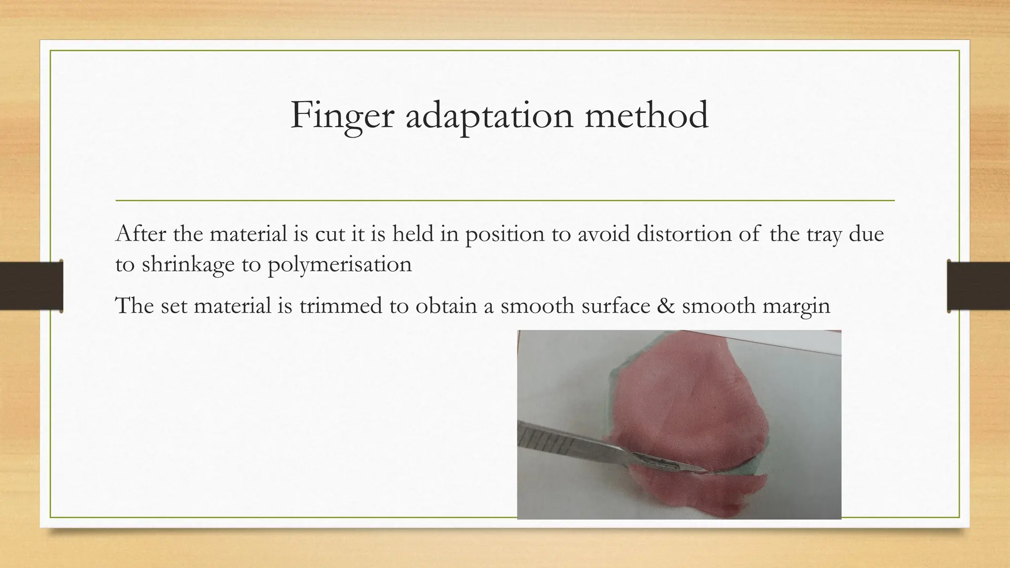 primary cast & special tray in complete dentures.pptx