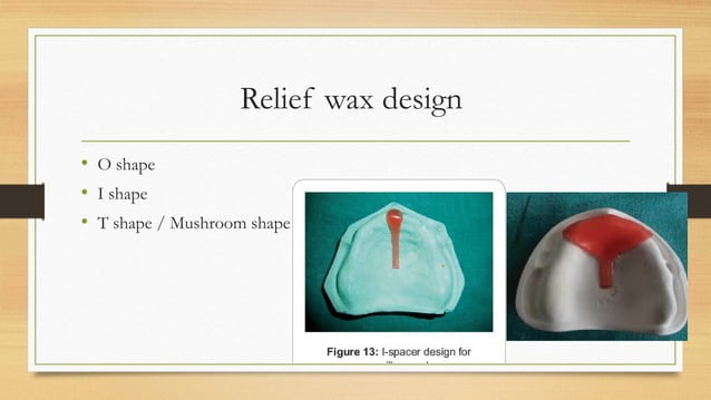 primary cast & special tray in complete dentures.pptx