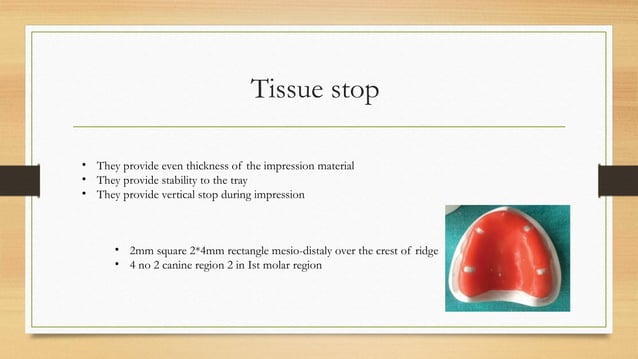 primary cast & special tray in complete dentures.pptx
