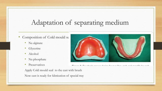 primary cast & special tray in complete dentures.pptx