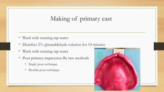 primary cast & special tray in complete dentures.pptx