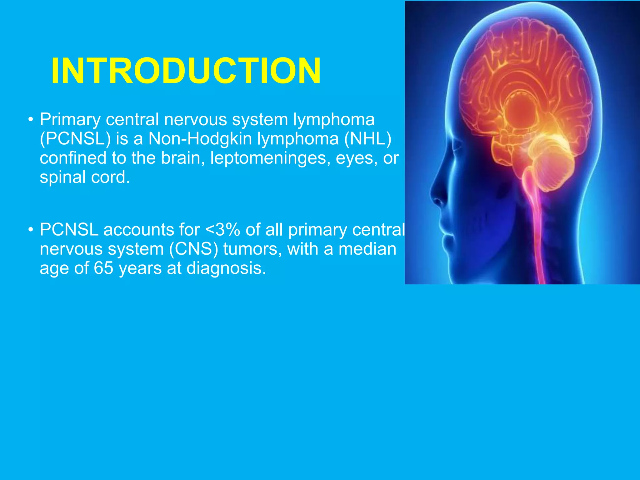 Primary CNS Lymphoma | PPTX