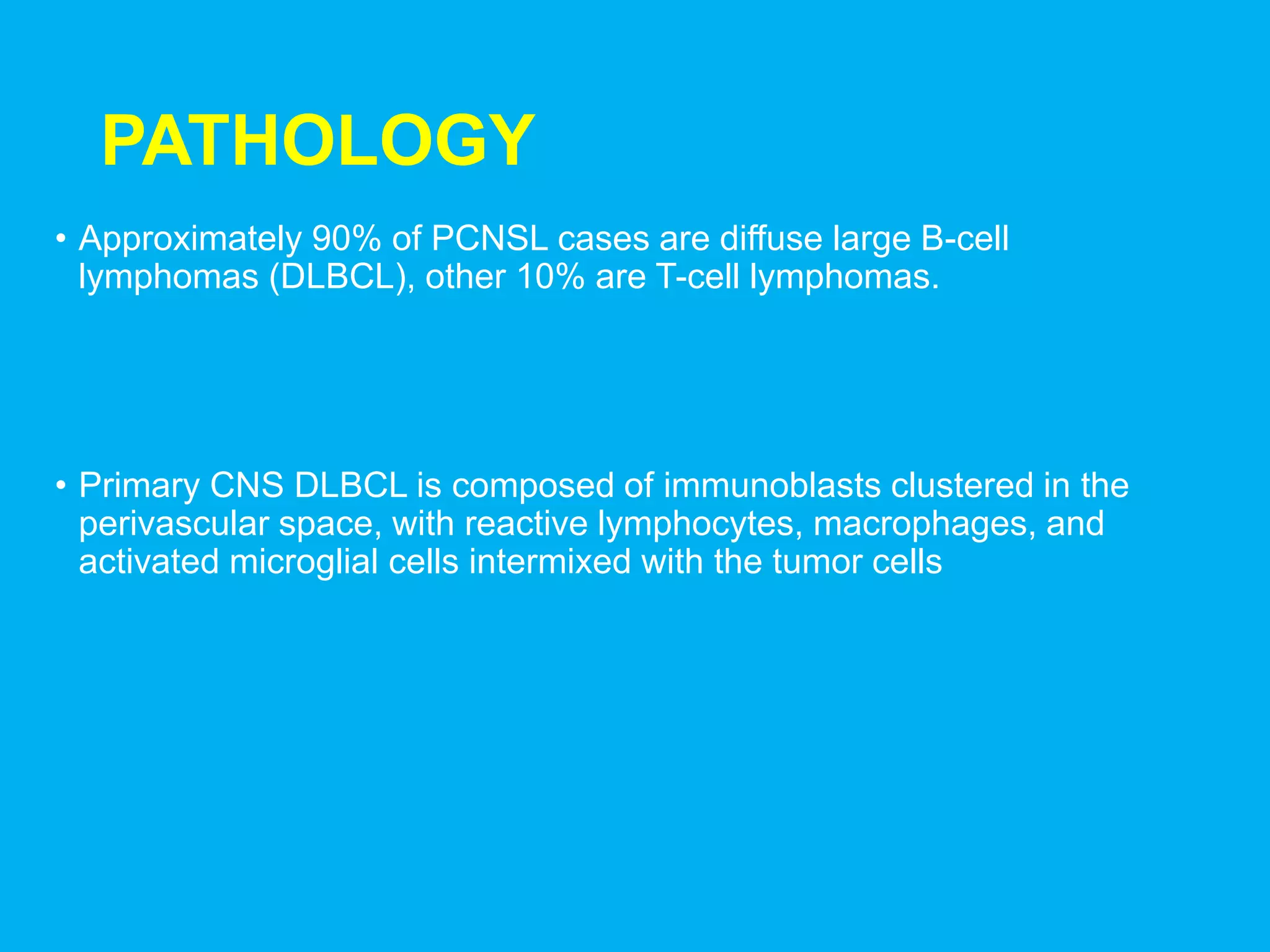Primary CNS Lymphoma | PPTX