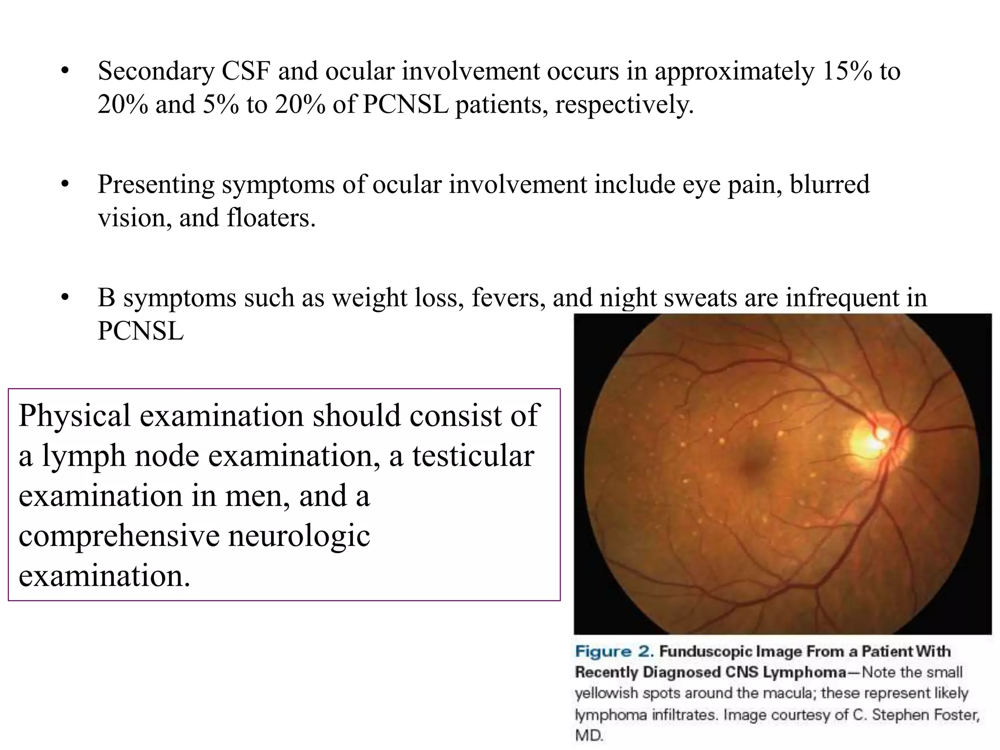 Primary cns lymphoma main | PPTX