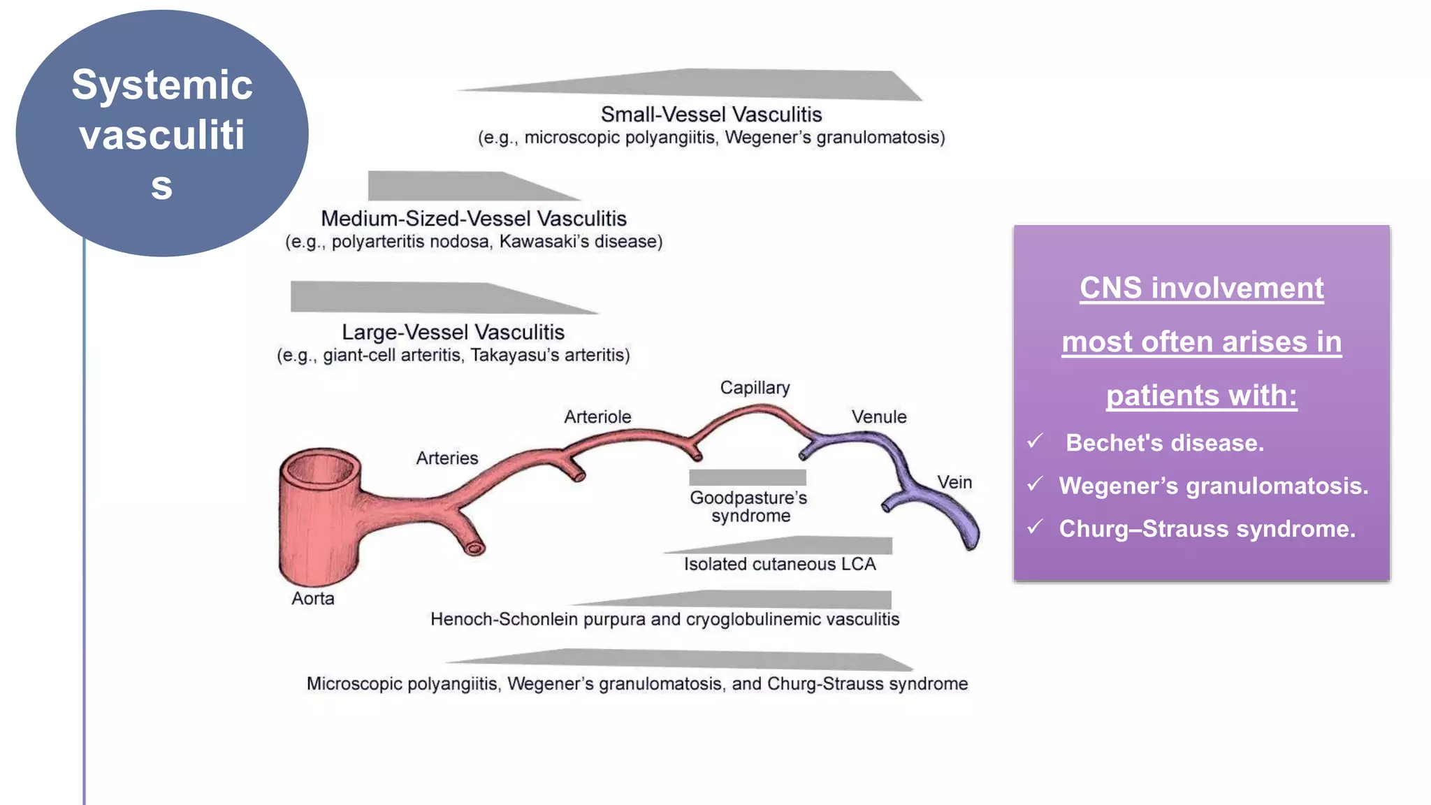 Primary cns vasculitis | PPTX