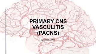 Primary cns vasculitis | PPTX