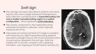 Neuroimaging in Traumatic Brain Injury: Primary effects of CNS Trauma ...