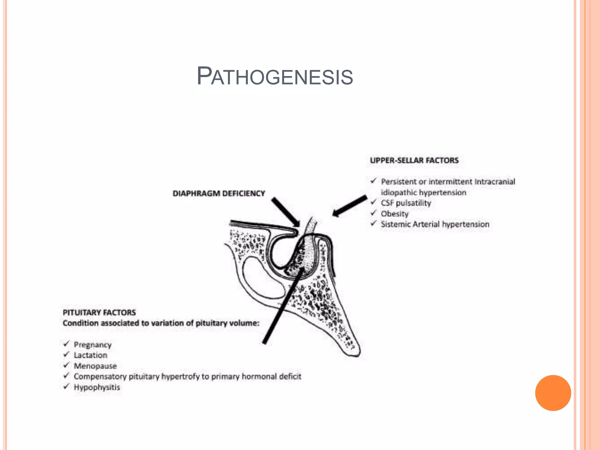 Primary Empty Sella | PPTX