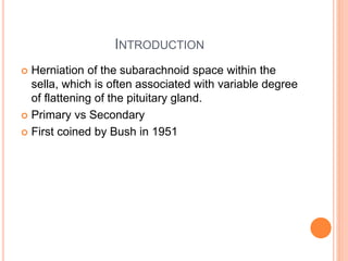 Primary Empty Sella | PPTX