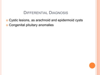 Primary Empty Sella | PPTX