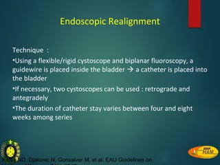 Primary endoscopic realignment | PPT