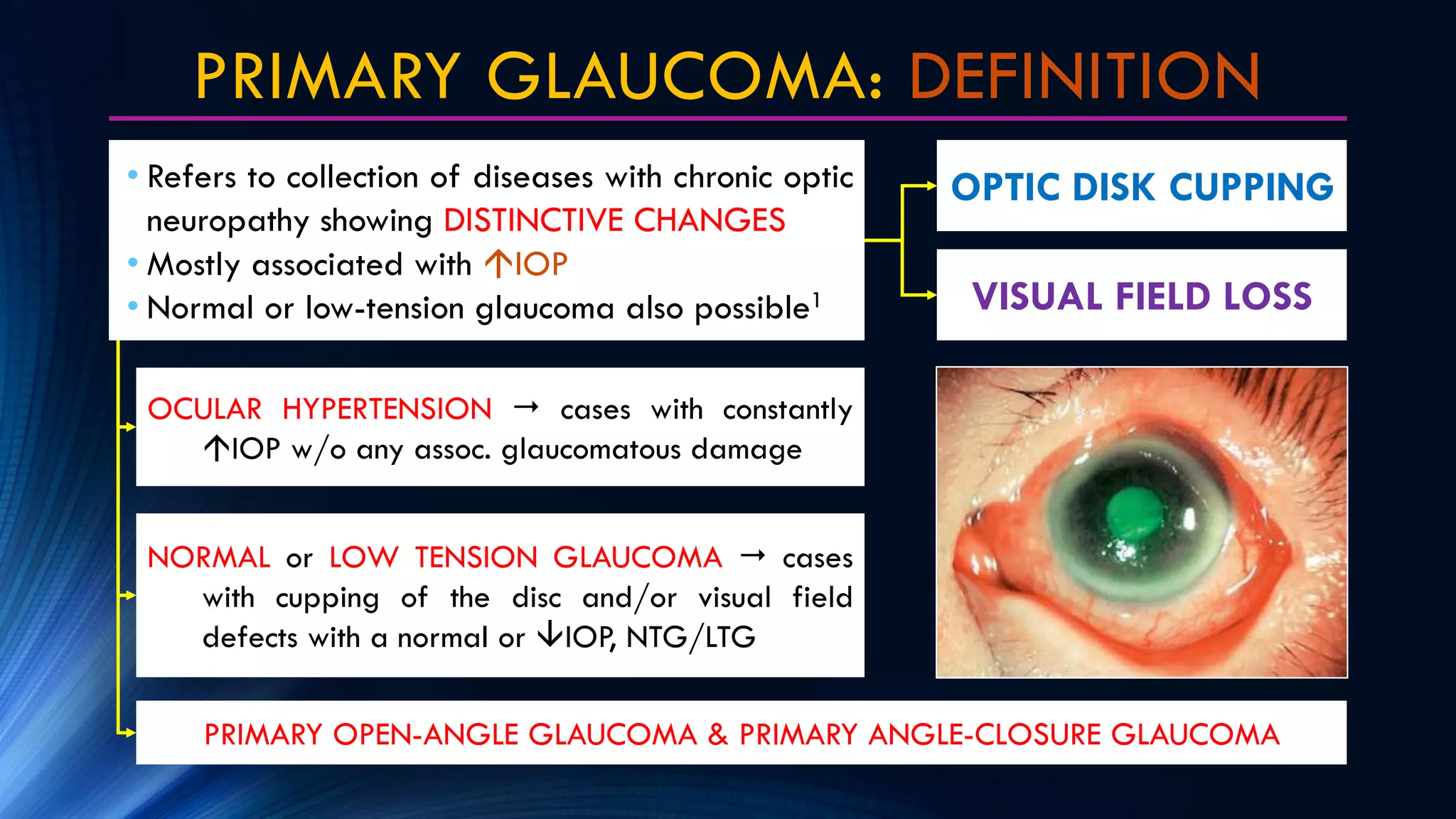 Primary Glaucoma | PDF