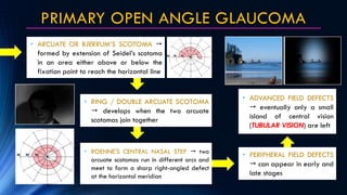 Primary Glaucoma | PDF