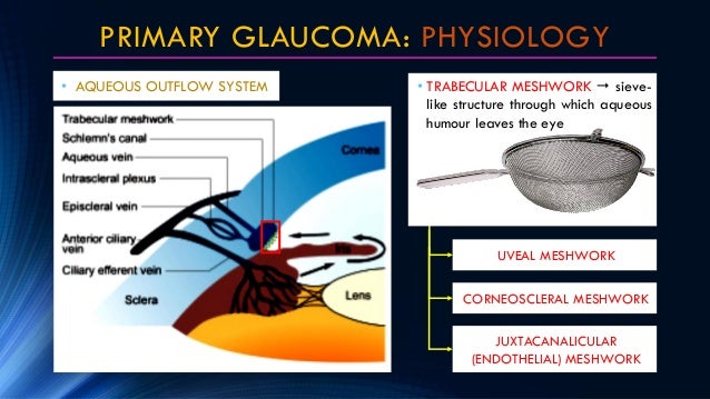 Primary Glaucoma