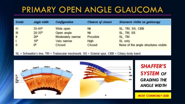 Primary Glaucoma